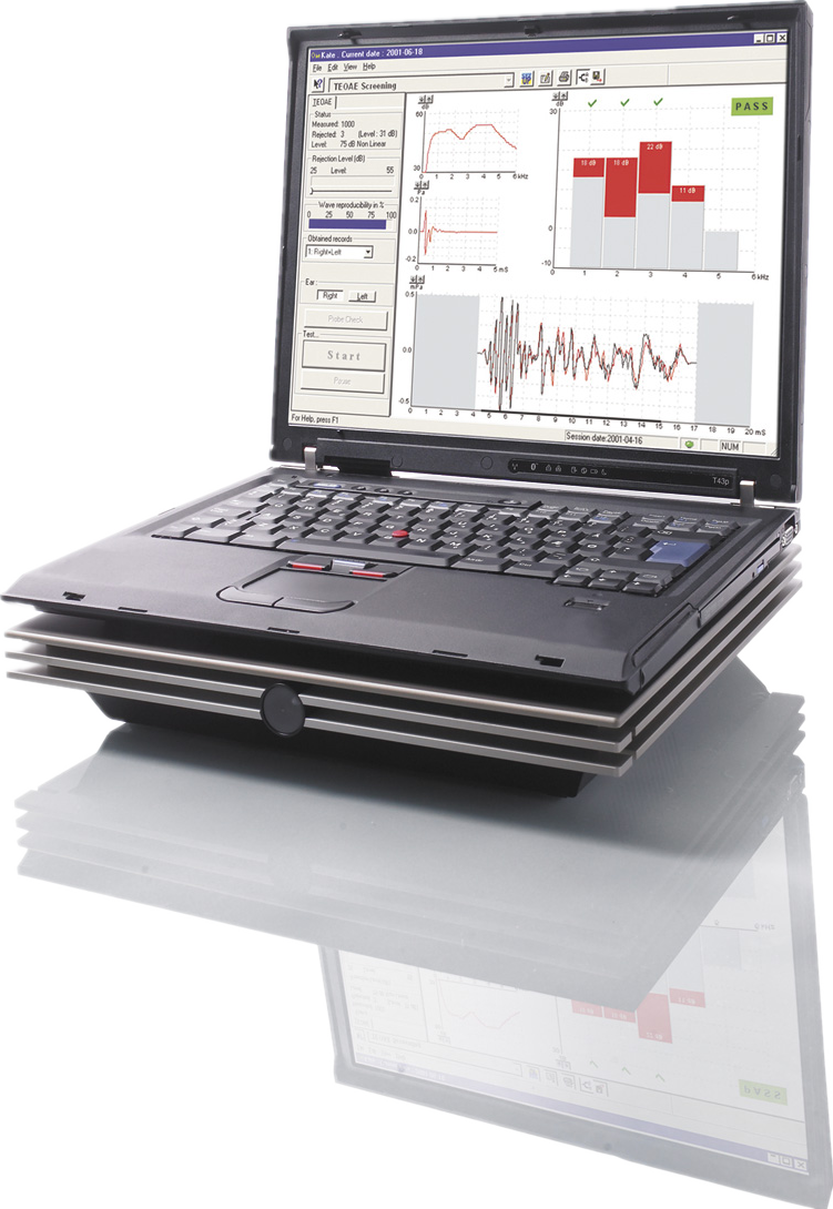 瞬态诱发耳声发射--TEOAE25